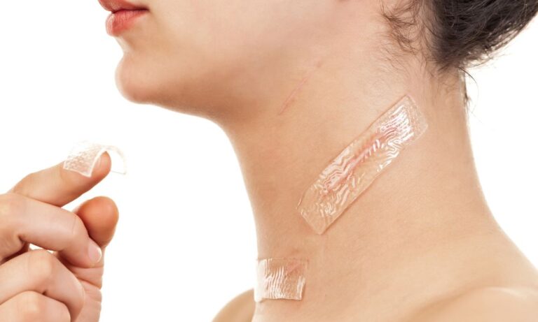 How to Naturally Dissolve Internal Scar Tissue | Apollo Soft Tissue and ...